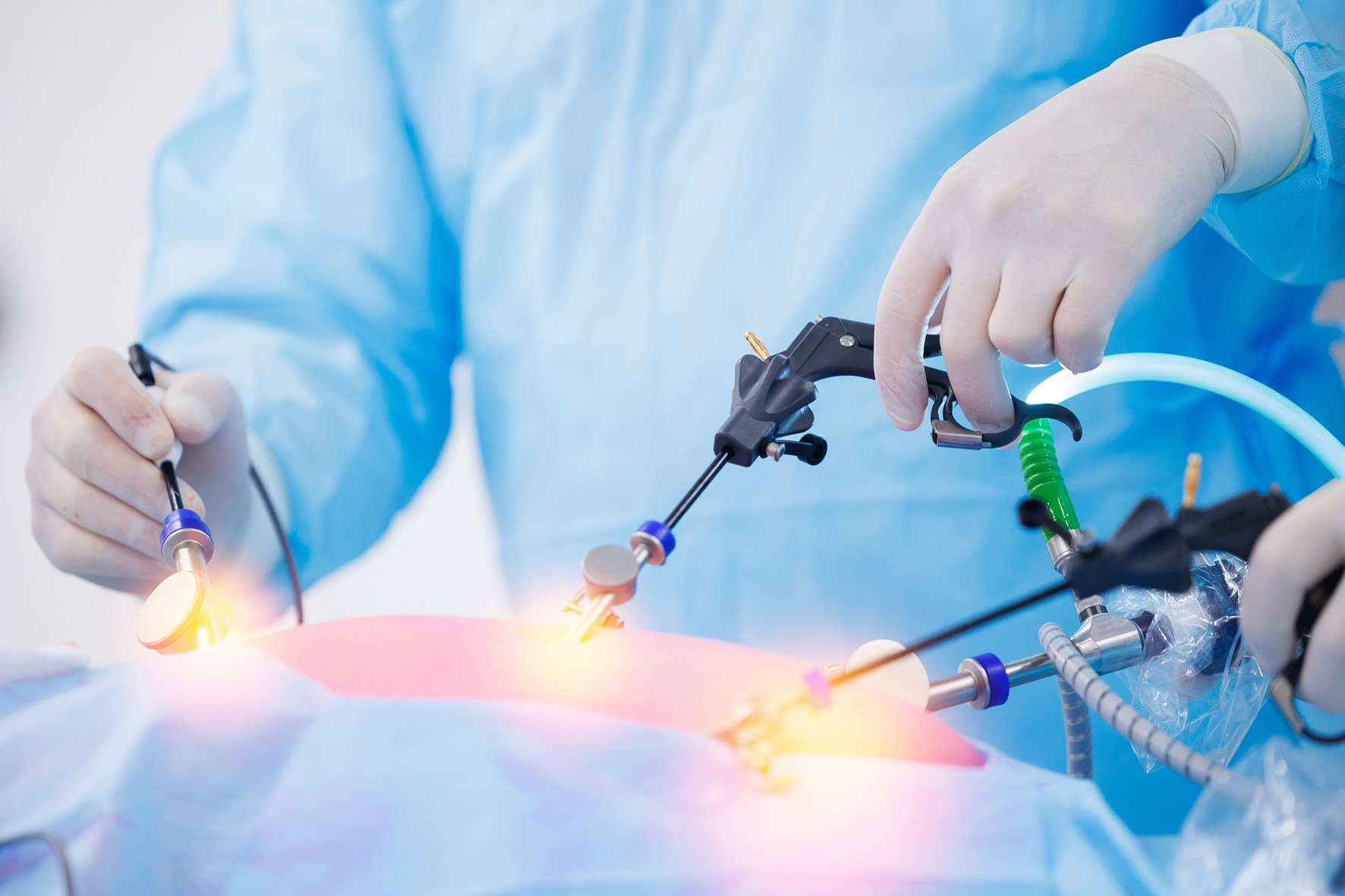 Laparoscopic Hysterectomy: What You Need to Know? - ranjitaghadei